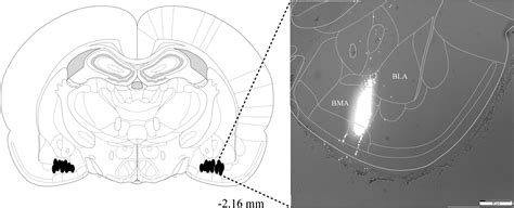 Figure 1 From Dissection Of Ventral Medial Prefrontal Cortex