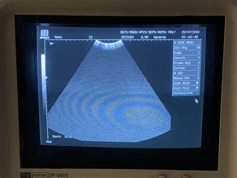Mindray C EA Convex Array Ultrasonic Transducer Genuine AusChoice