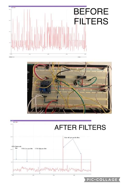 Cleaning Up Interference In Brain Signal With Active High And Low Pass