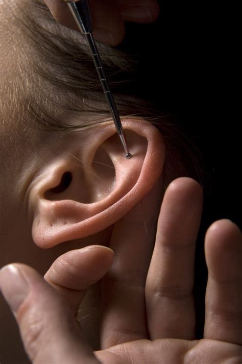Ear Acupuncture Points Shenmen At Victor Gordon Blog