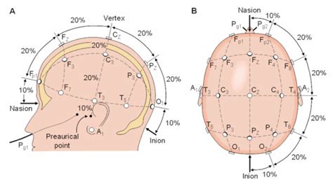 The 10 20 System In Eeg Mapping Brainwaves With Precision Dr Srinivas Rajkumar Md