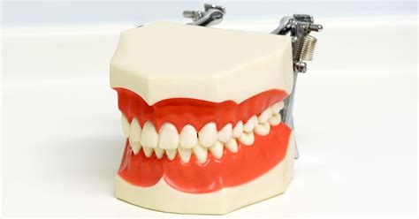 What Is Functional Orthodontics Orthopaedic Specialists