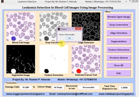 Early Stage Leukemia Blood Cancer Detection Using Matlab Source Code IEEE Based Projects