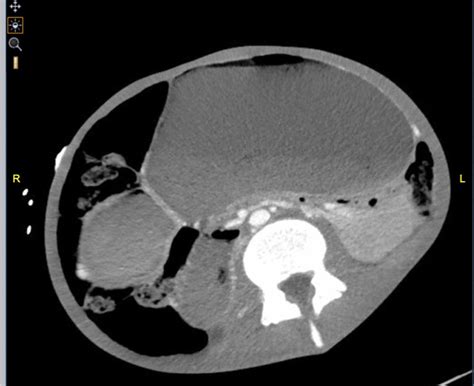 Computed Tomography Transverse View Download Scientific Diagram