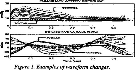 Energy Gainslosses Of Normal And Fontan Circulations In Lambs Under Varying Respiration