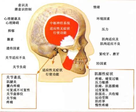 颞下颌关节紊乱（三） 知乎