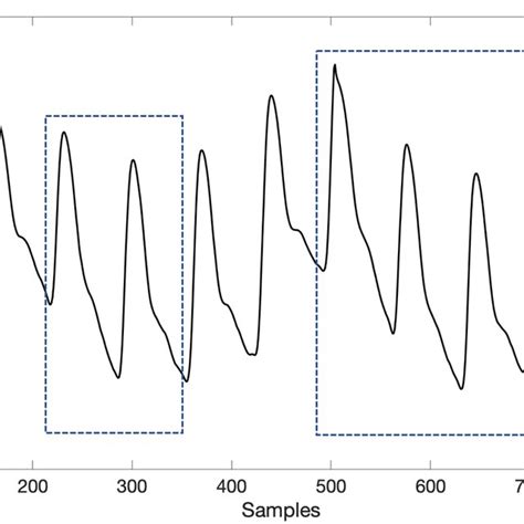 Sample Ppg Waveform From Mimic Ii Database Containing Undetectable Download Scientific Diagram Sample Ppg Waveform From Mimic Ii Database Containing Undetectable Download Scientific Diagram