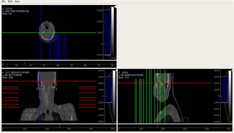 Imageview Not Refreshing Properly Infinitelineqlabel · Issue 500 · Pyqtgraphpyqtgraph · Github