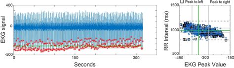 Graphical Output Produced By Eeg Beats Left Ekg Signal Acquired Using