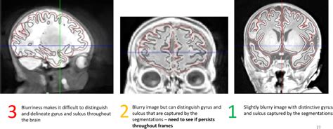Post Processing Quality Assessment From Executive Summary Dcan Labs