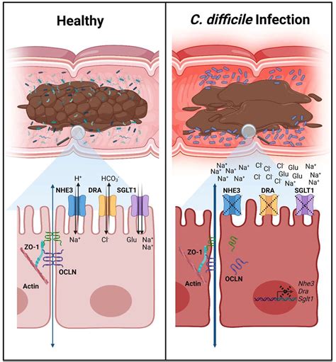 Toxin Mediated Downregulation Of Absorptive Ion Transporters Nhe3 Dra