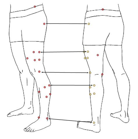 Muscle Activity And Kinematics During Three Hamstring Strengthening