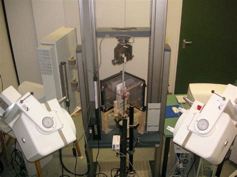 Rsa Setup Simultaneous Exposure Of An Anteroposterior View And A