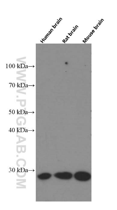 Calbindin D28k Antibody 66394 1 Ig Proteintech