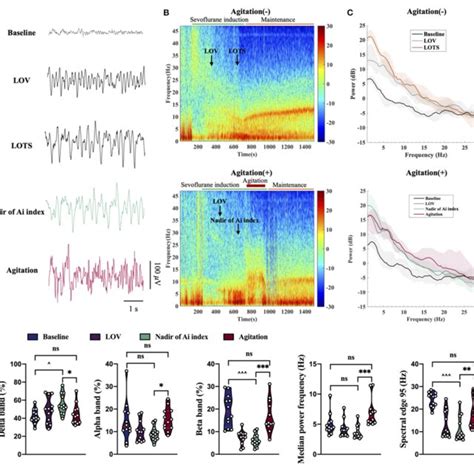 Unprocessed EEG Waveform Spectrogram Spectrum And EEG Analysis From
