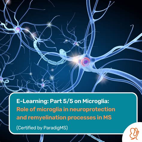 Paradigms Foundation On Linkedin E Learning Part 55 On Microglia Role Of Microglia In