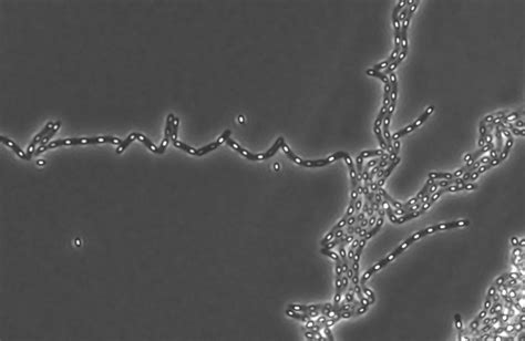 of bacteria and men filamentous bacteria under the microscope
