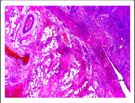 Figure 4 From The Duplication Of The Appendix A Look Crossed Between