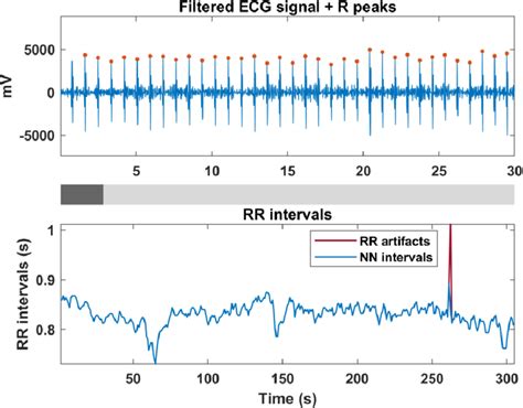 4 Filtered And Smoothed Ecg Signal With Identified R Peaks Top