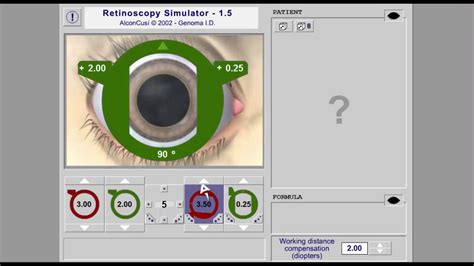 mÔ phỎng soi bÓng ĐỒng tỬ bẰng app objective refraction retinoscopy