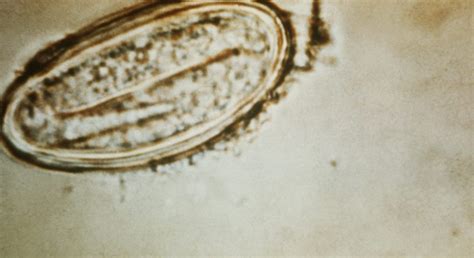 Dientamoeba Fragilis Symptoms Testing And Natural Treatment Byron Herbalist