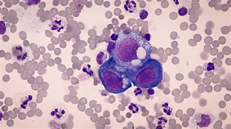 Observations On Oncology Biomarker Testing Incrowd