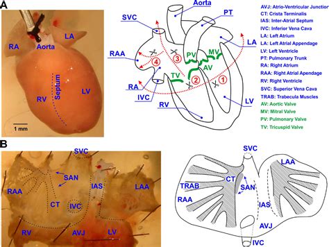 High Resolution Optical Mapping Of The Mouse Sino Atrial Node Video