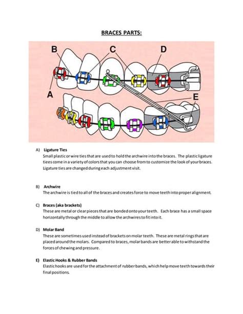Braces Parts Pdf