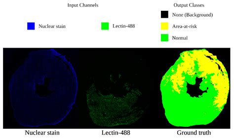 Bioengineering Free Full Text Synergizing Deep Learning Enabled Preprocessing And Humanai