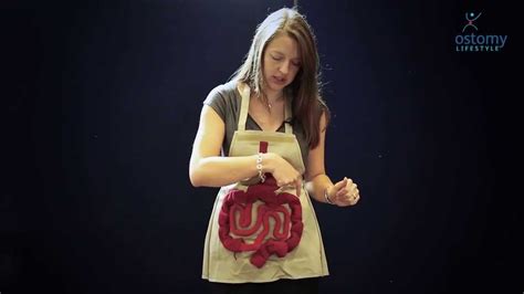 A Quick Explanation Colostomy Ileostomy Urostomy By Ostomy Lifestyle Ostomy Ostomy Care