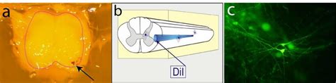 7 Axonal Tract Tracing Procedure A Spinal Cords Of P14 15 Rats Were