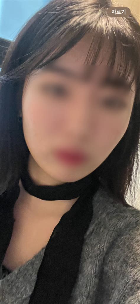 시술 수술 질문 유라인 윤곽주사 광 강남언니 1등 성형수술and피부시술 정보앱