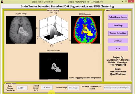 Brain Tumor Detection Using Som Segmentation And K Clustering Matlab