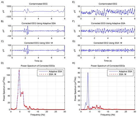 An Adaptive Singular Spectrum Analysis Method For Extracting Brain Rhythms Of