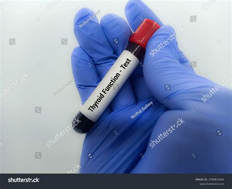 Tumor Marker Test Function Résultats 22 Dimages Libres De Droits De Photos De Stock Et D