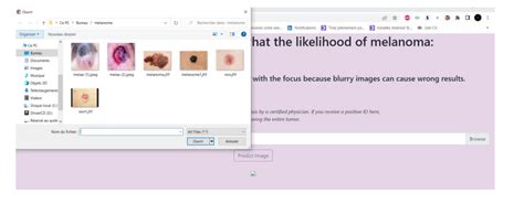 Github Yasmine01545skin Cancer Diseases Classification Using Transfer Learning And Flask In