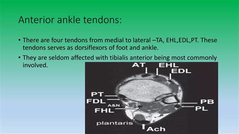 Mri Anatomy Of Ankle Radiology Ppt Pk Pptx