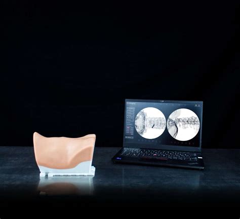 Innport Realists Anterior Cervical Innport