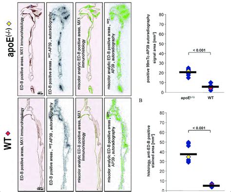 Representative Aortic Tissue Sections And Analyses 99m Download Scientific Diagram