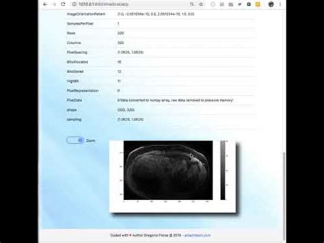 GitHub Bygregonline Dicom Django Viewer TUTORIAL Django Bootstrap DICOM Online Viewer