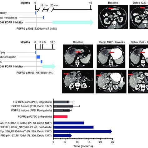 Patients With Fgfr2 Eids Have Prolonged Clinical Responses To Fgfr Download Scientific Diagram