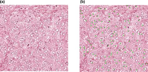 finding critical nuclei a original image b detecting critical