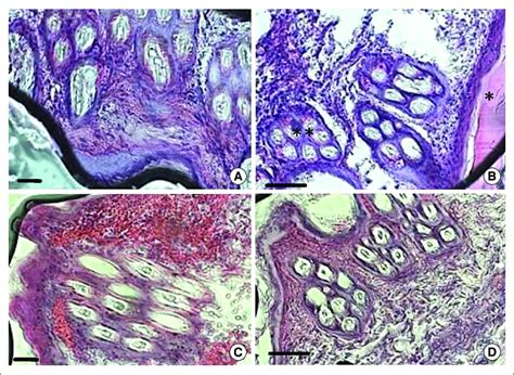 Histopathology Of Rabbit Skin From The Control Versus Antihistamine