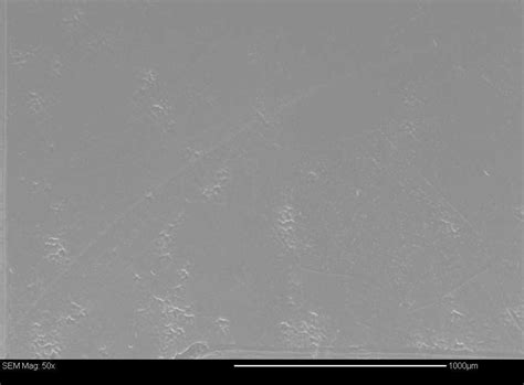 Any Advice On Ebsd Pattern Quality Researchgate