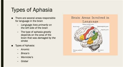 8 Different Types Of Aphasia Aphasia Vs Dysphasia 8 Key Differences