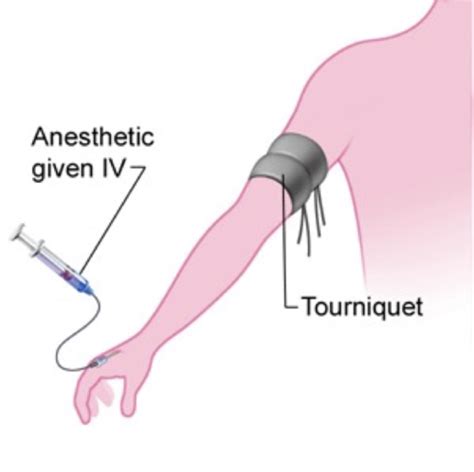 Anesthesia Flashcards Quizlet