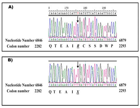 Ssequence Chromatogram Showing The Region Of Exon 20 Of Setx Gene Where