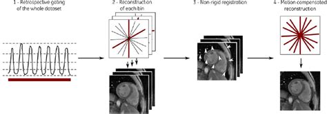 Scheme Of The Motion Compensated Reconstruction Mcr Download Scientific Diagram