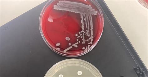 Scientists Reveal Search For Faster Way To Diagnose Mrsa And Its Relatives News The