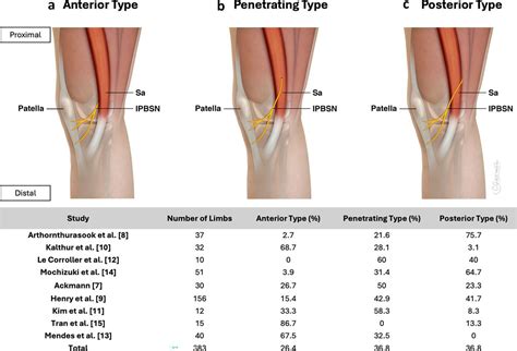 Saphenous Nerve Block